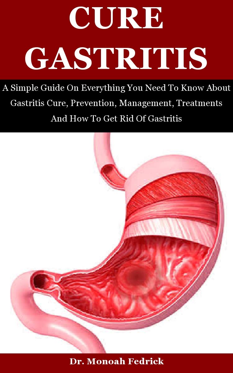 Buy Cure tritis: A Simple Guide On Everything You Need To Know About ...