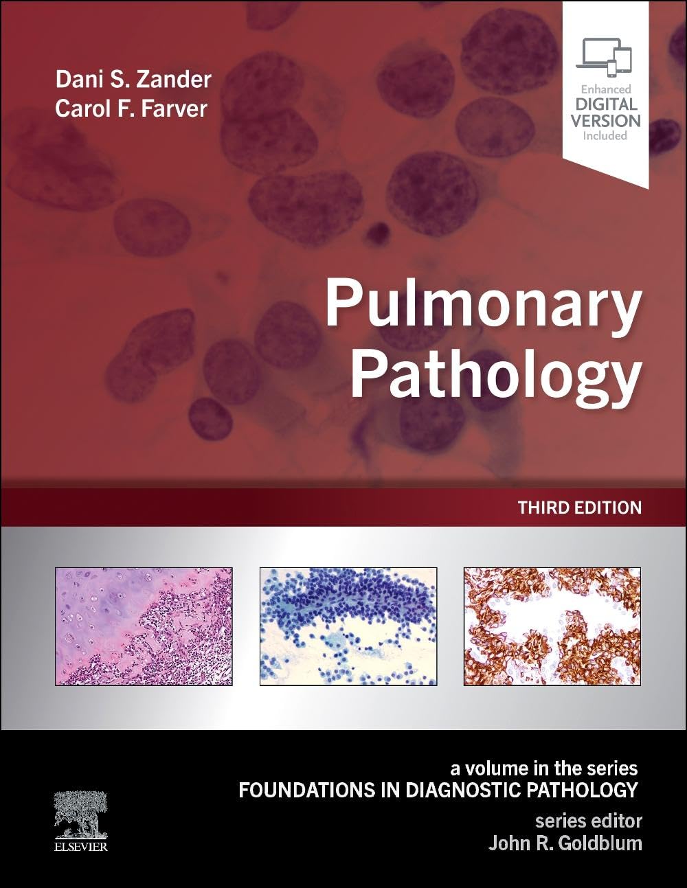Pulmonary Pathology (Foundations in Diagnostic Pathology ...
