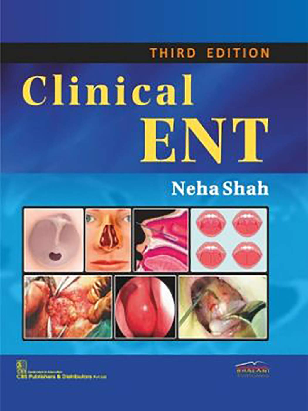 Buy Clinical ENT, 3e (HB) [Paperback] Neha Shah Book Online at Low ...