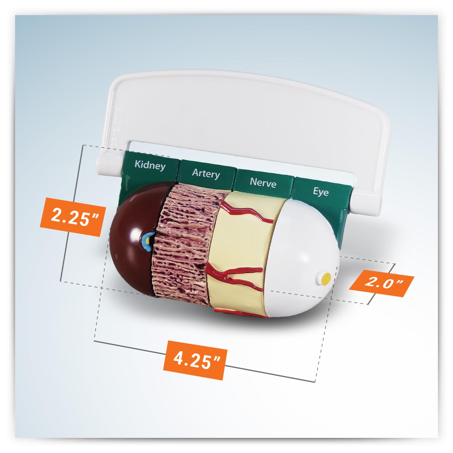 Snapklik.com : 4-PieceDiabetes Model, Replica Showing Vascular Effects ...