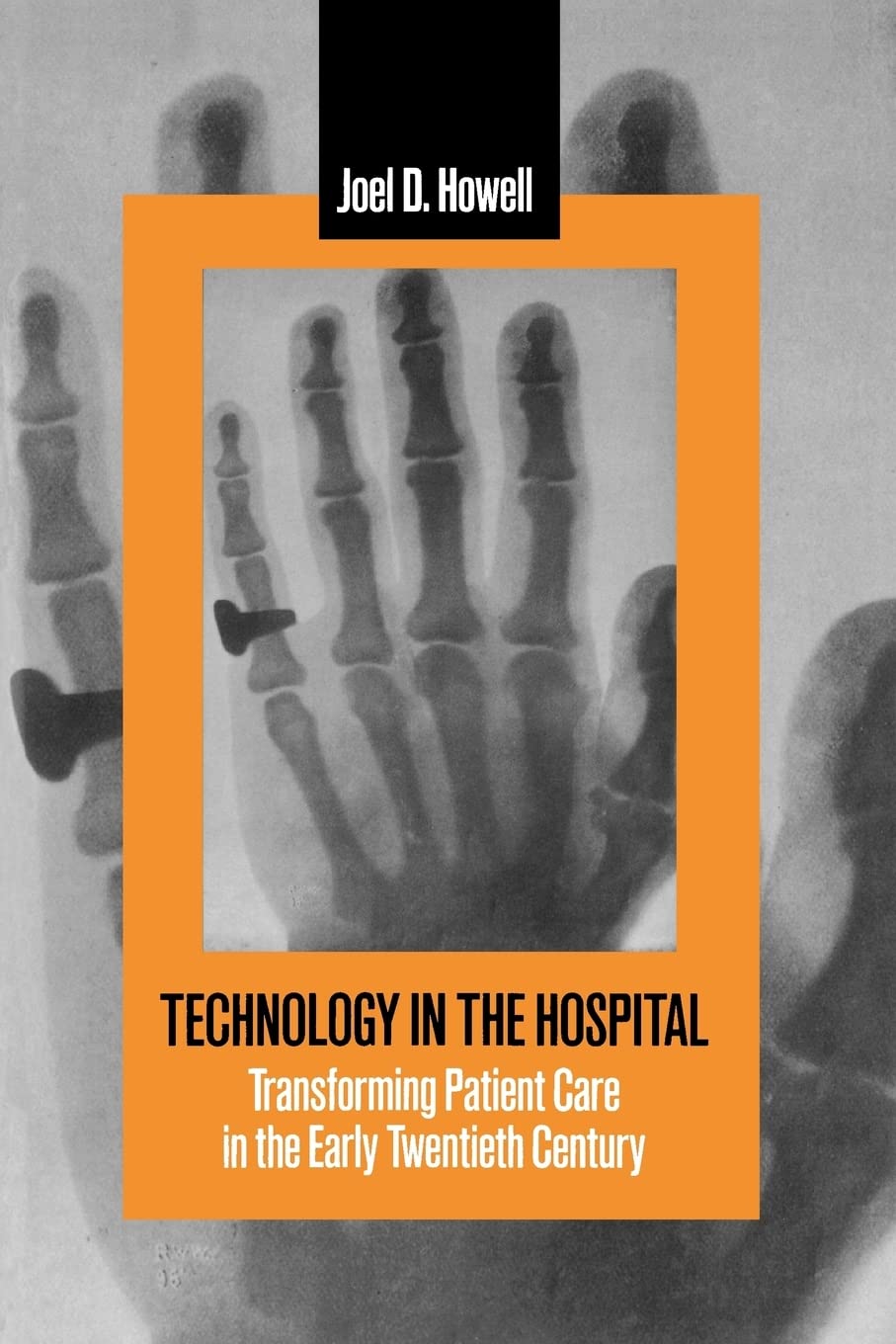 Technology in the Hospital: Transforming Patient Care in the Early ...
