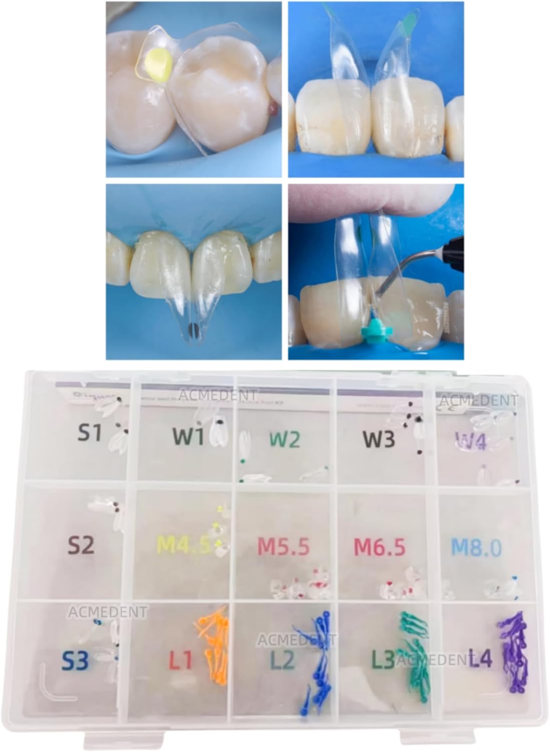 Amazon.com: Clear Matrix Dental BT Matrices Black Triangle Wedges ...