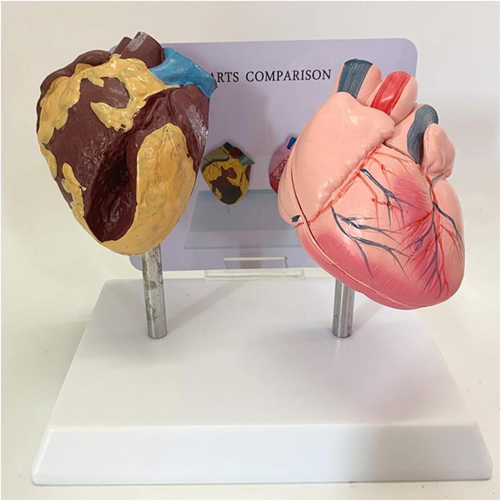 Smokers Human Heart 8 Steps To A Healthy Heart | Lovelace Health