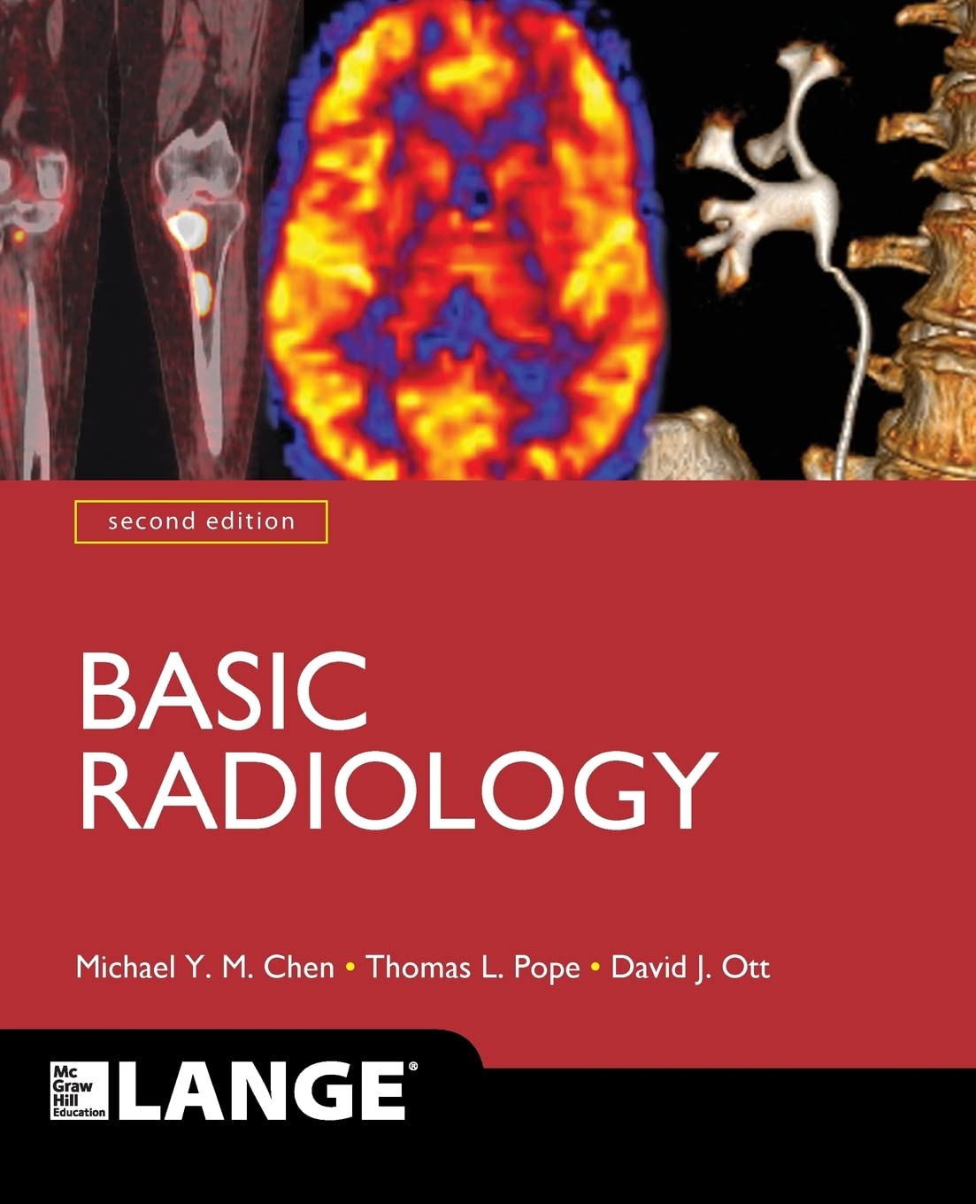 Basic Radiology, Second Edition (LANGE Clinical Medicine ...