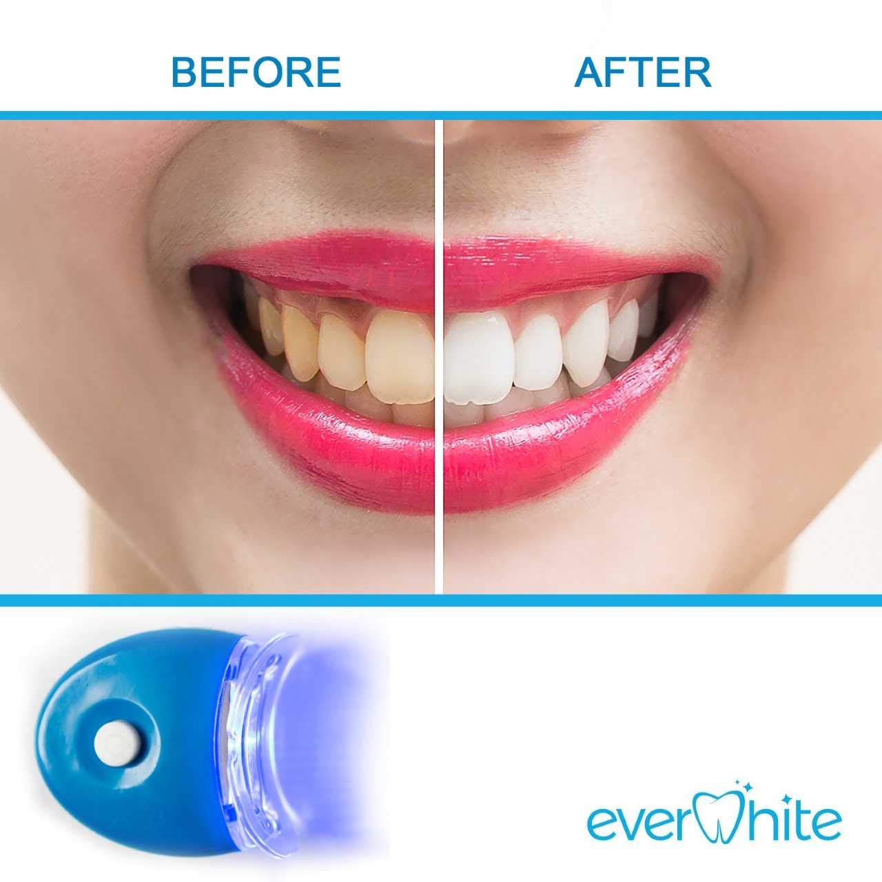 Blue Lip Gloss Whiter Teeth