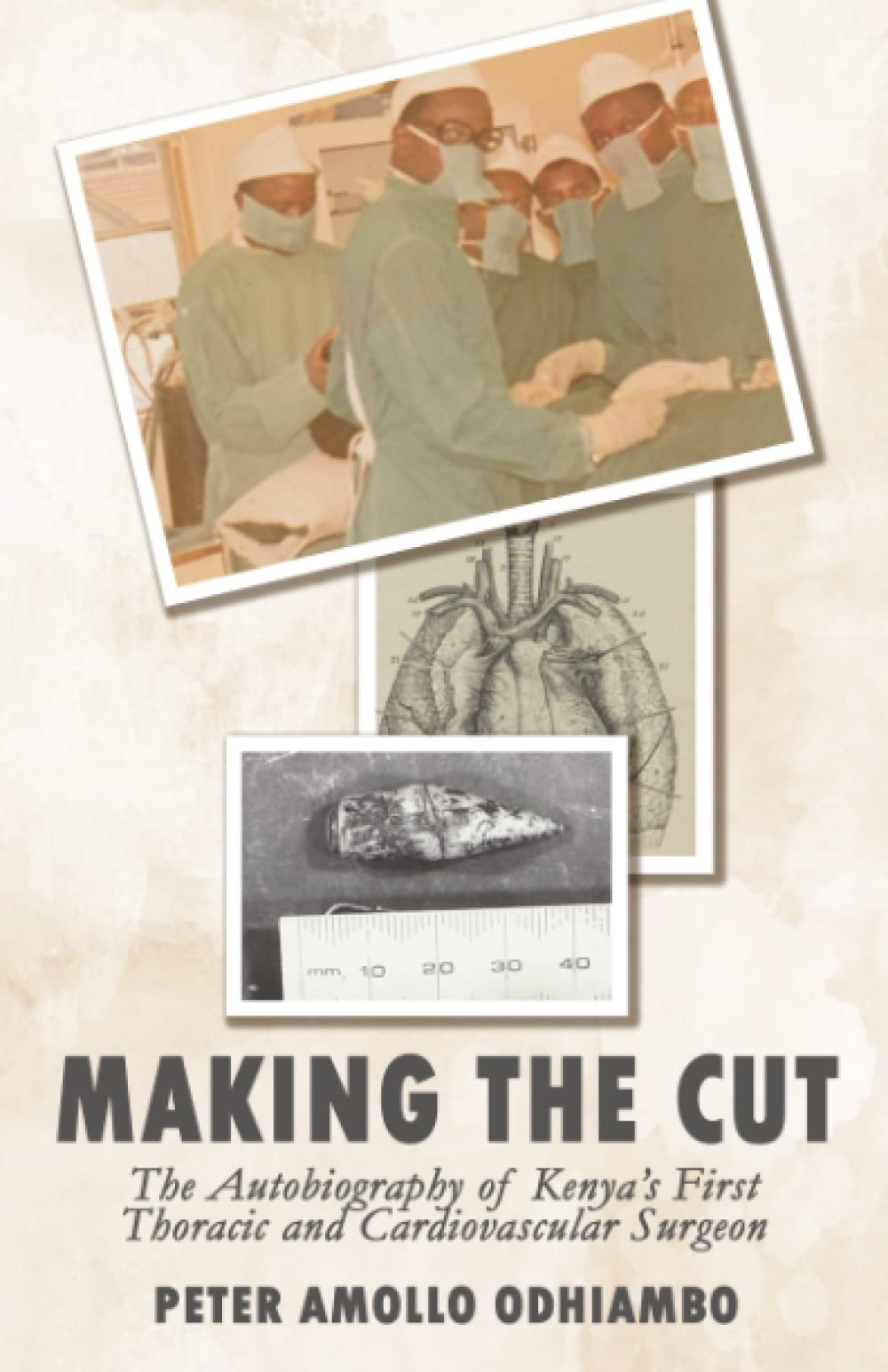 Making the Cut: The Autobiography of Kenya's First Thoracic and ...