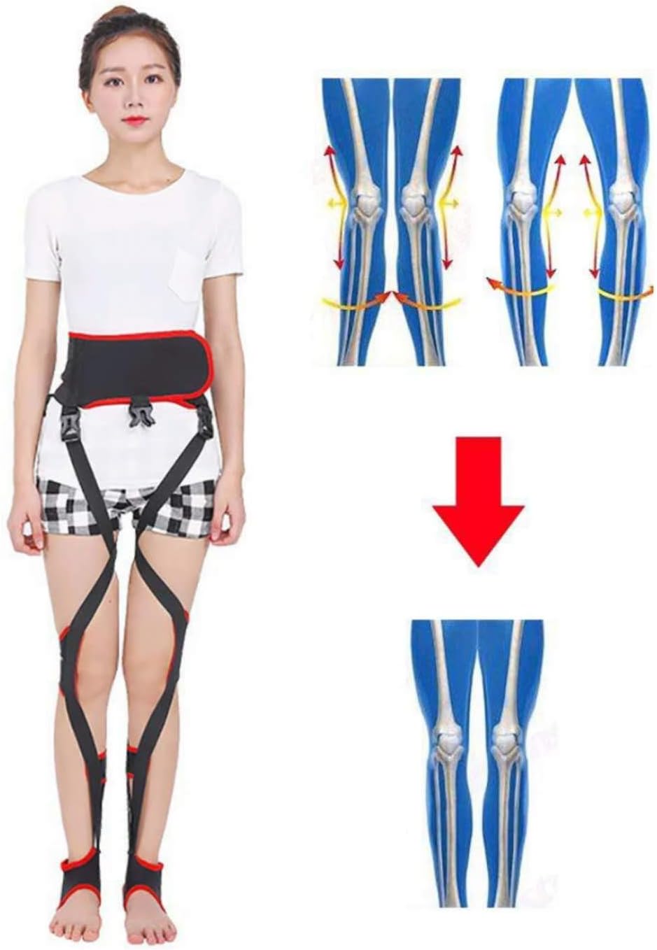 Amazon.com: MEET Adjustable Leg Posture Corrector, O/X Type Leg ...