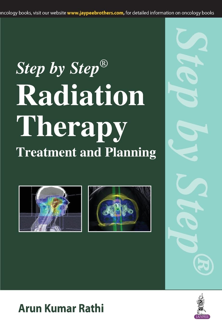 Step by Step Radiation Therapy: Treatment and Planning: 9789352501243 ...
