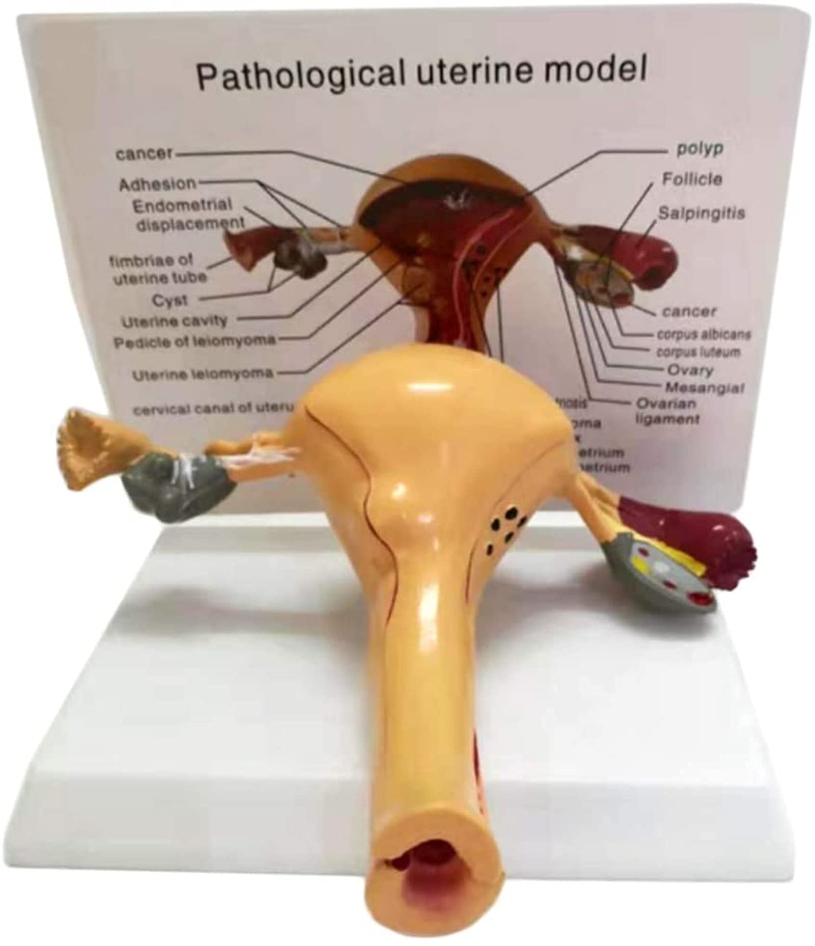 Pakues Qo Study Model Uterus Model Medical Anatomical Human Uterus ...