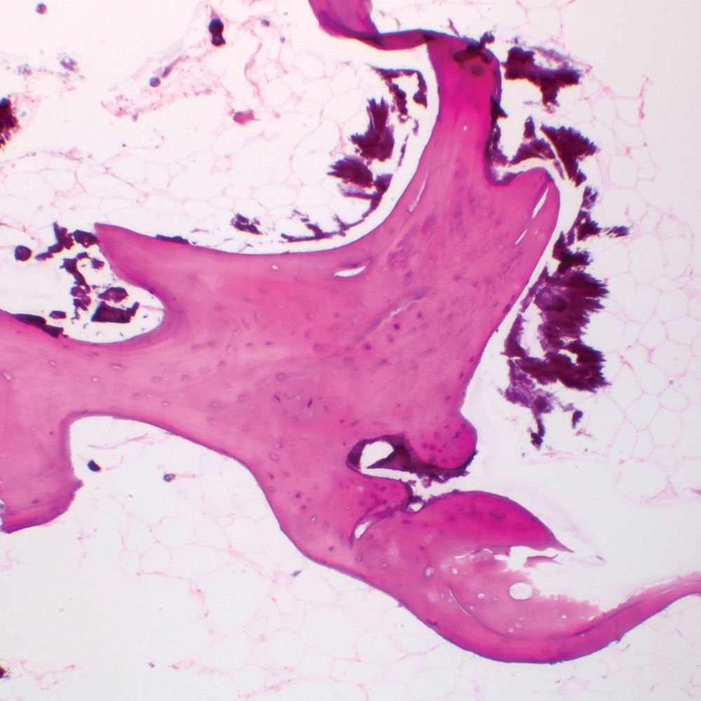 Spongy Bone Under Microscope
