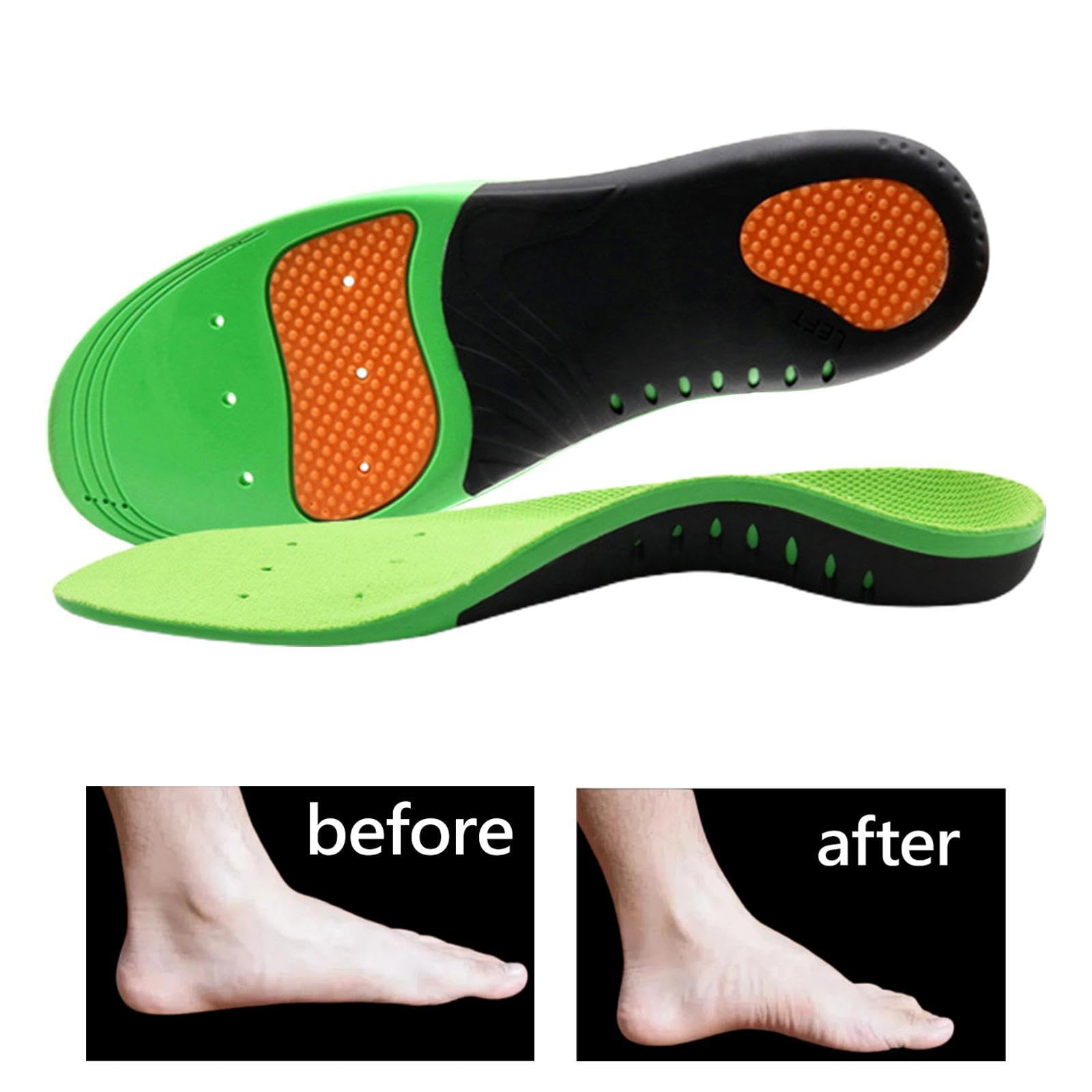 Pigeon Toed Athletes Pigeon Toe Intoeing Beaver Valley Foot Clinic