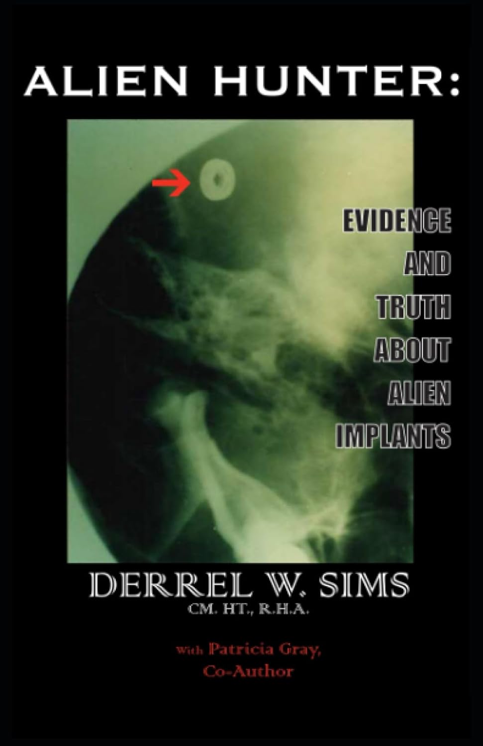 Amazon.com: Alien Hunter Evidence and Truth about Alien Implants ...