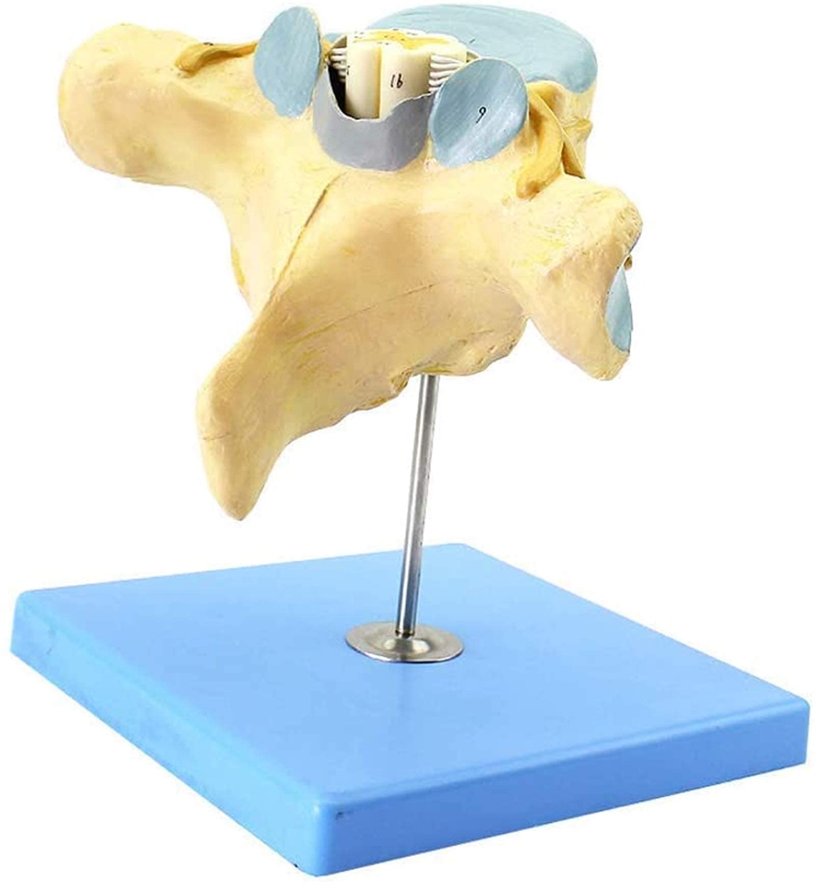 Aipipl Study Model Educational Model Enlarged Model Of Human Lumbar ...