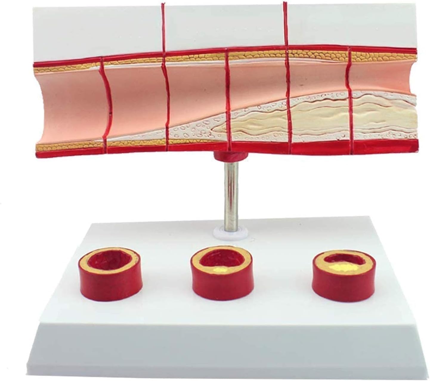 Amazon.com: CHROX PVC Body Model, Cardiovascular Cholesterol Model ...