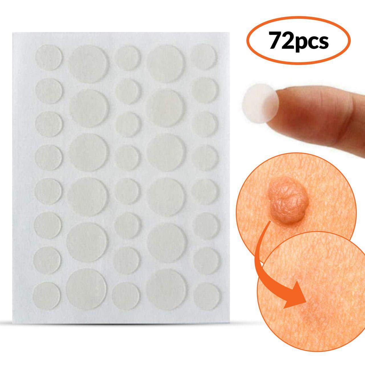 Skin Tag And Acne Remover Patches 72 Pcs Natrual Ingredients ...