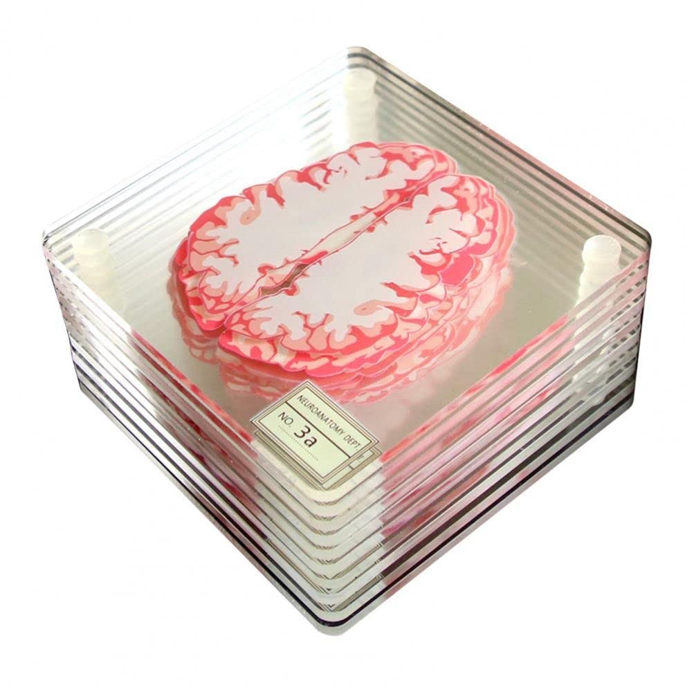 Amazon.com: 10Pcs Brain Specimen Coasters,Brain Slices Square Acrylic ...