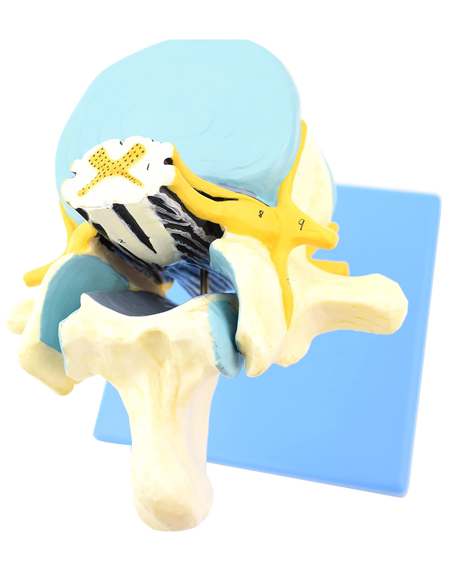 Buy GOD Human Lumbar Spine Model Cord And Cauda Equina Anatomy ...