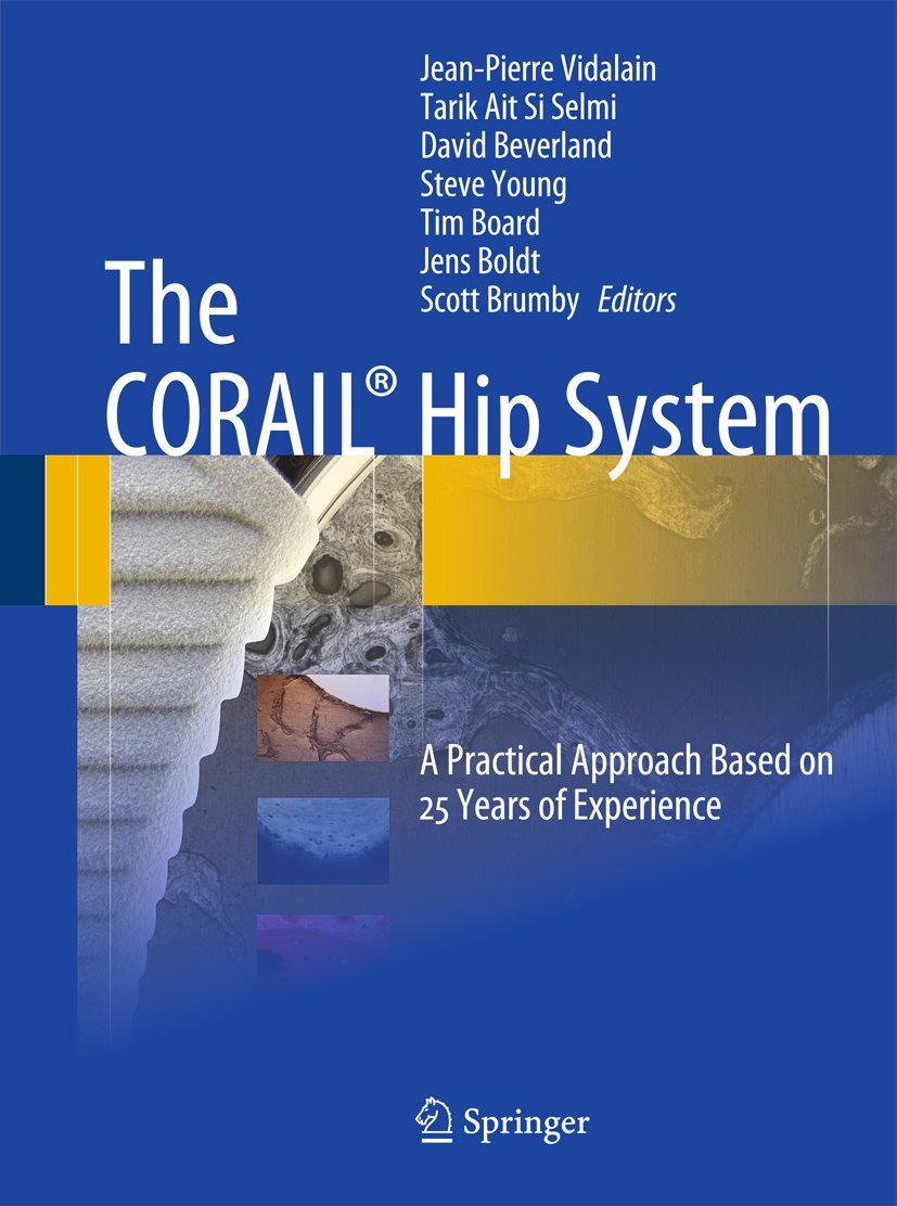 The CORAIL® Hip System: A Practical Approach Based on 25 Years of ...