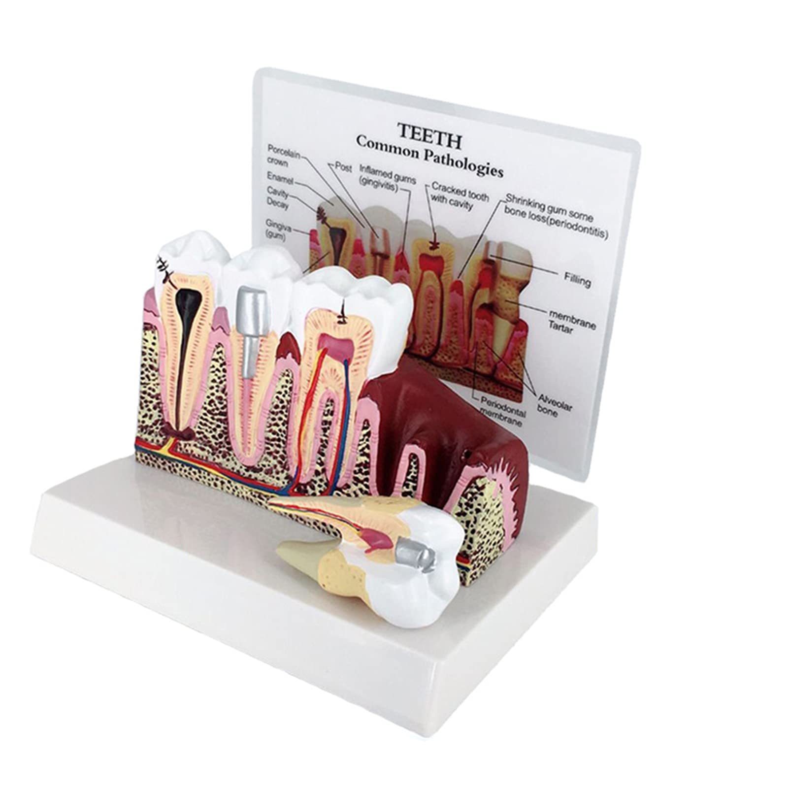 Buy Tooth Oral Teaching Model, Detachable Tooth Anatomical Model, Teeth ...