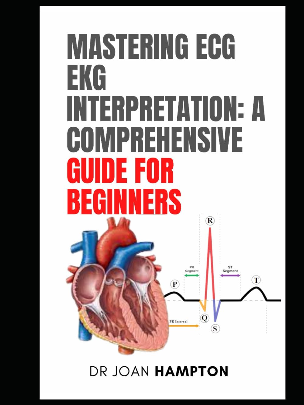 Mastering ECG EKG Interpretation: A Comprehensive Guide for Beginners ...