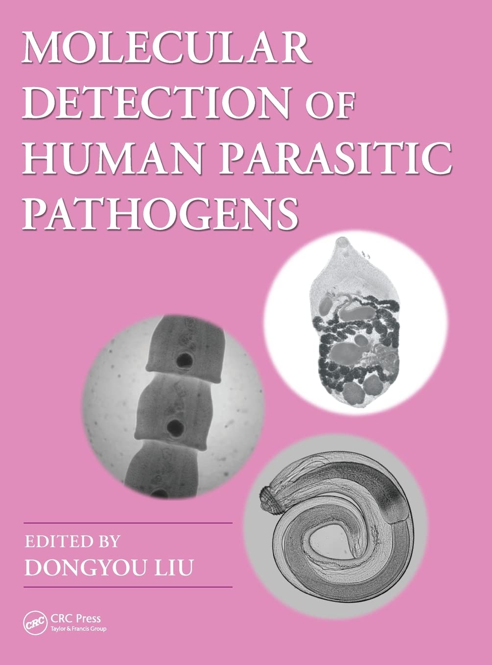 Molecular Detection of Human Parasitic Pathogens: 9781439812426 ...