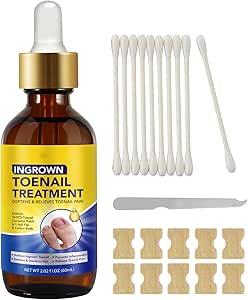 Ingrown Toenail Treatment, Toenail Softener for Fast Relief, Ingrowing ...