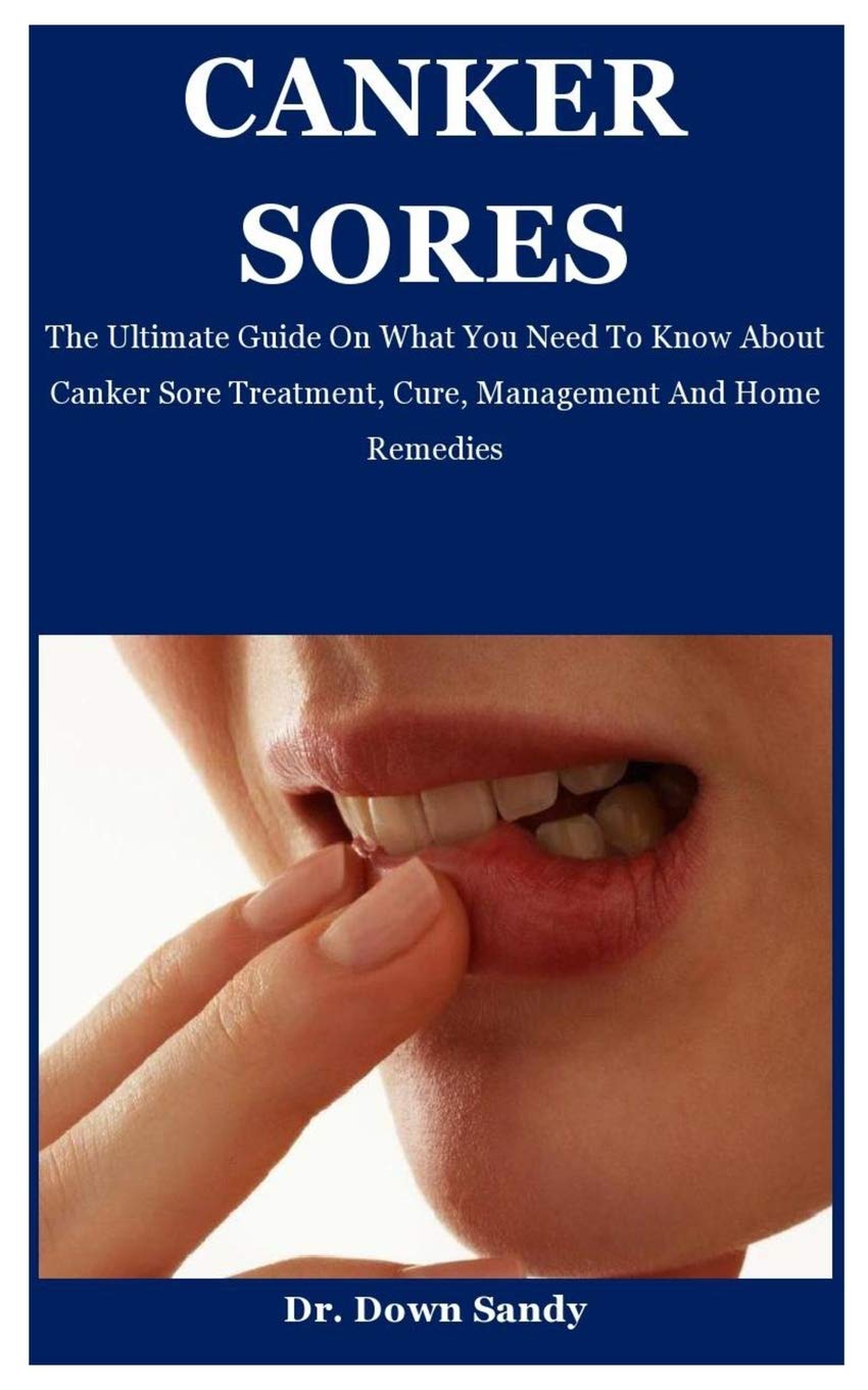 Buy Canker Sores: The Ultimate Guide On What You Need To Know About ...
