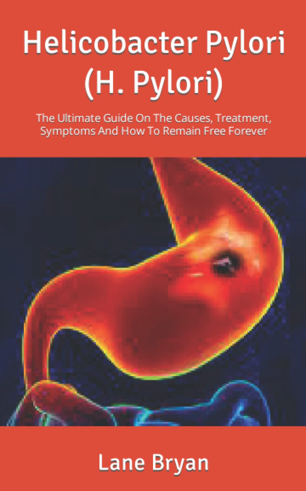 Buy Helicobacter Pylori (H. Pylori): The Ultimate Guide On The Causes ...