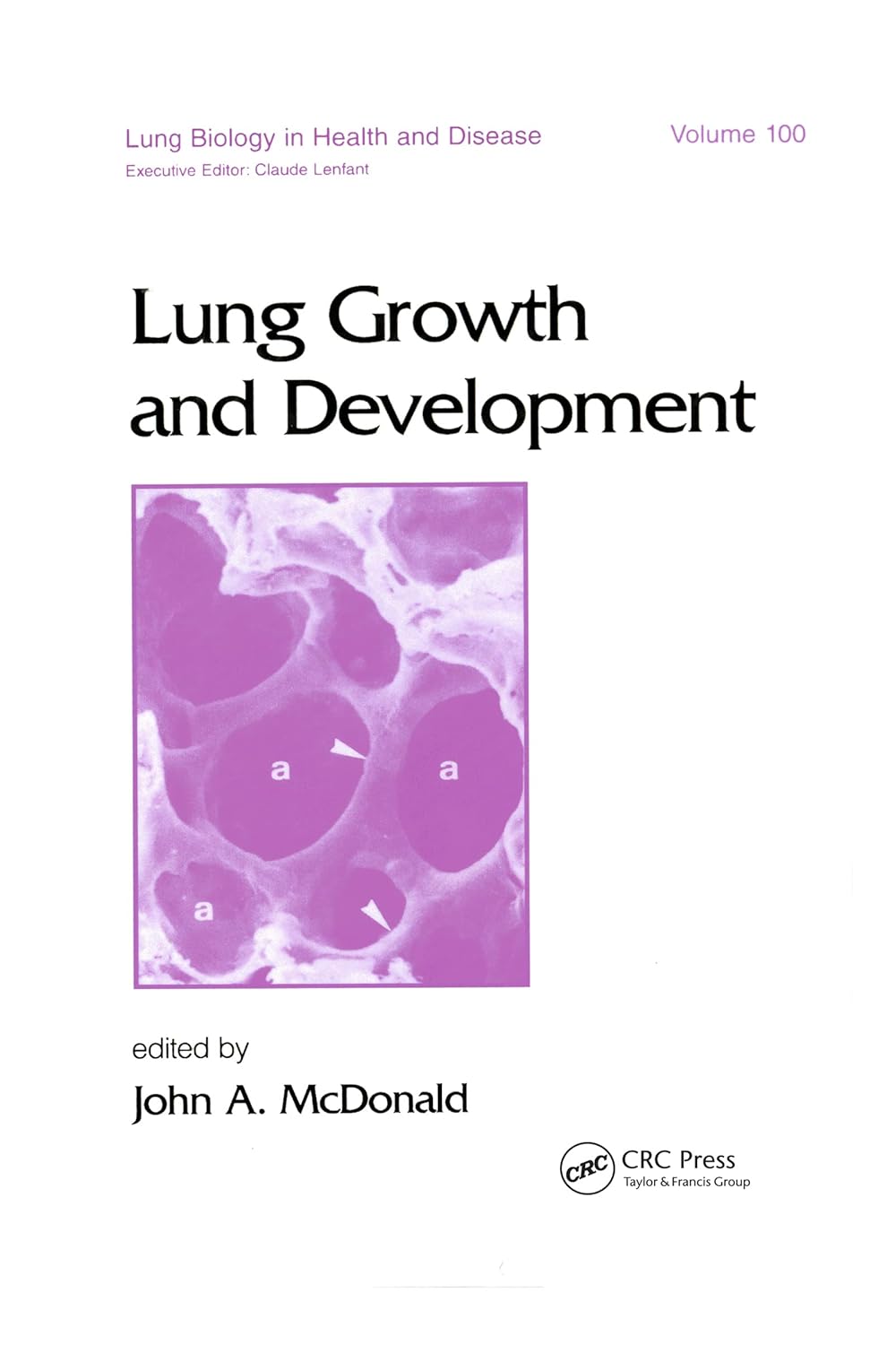 Lung Growth and Development (Lung Biology in Health and Disease ...