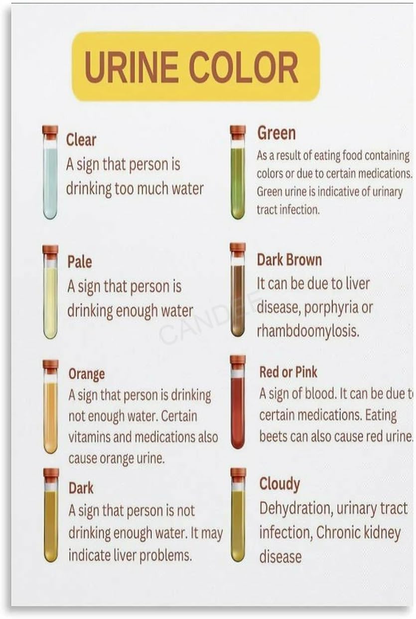 Amazon.com: Urine Color Issues And Health Status Urine Color Chart ...