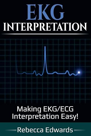EKG Interpretation: Making EKG/ECG Interpretation Easy!: Edwards ...