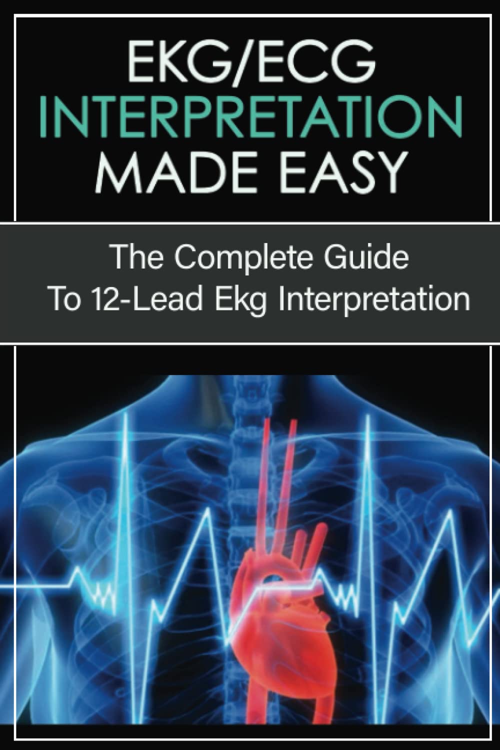 Ekg/Ecg Interpretation Made Easy: The Complete Guide To 12-Lead Ekg ...