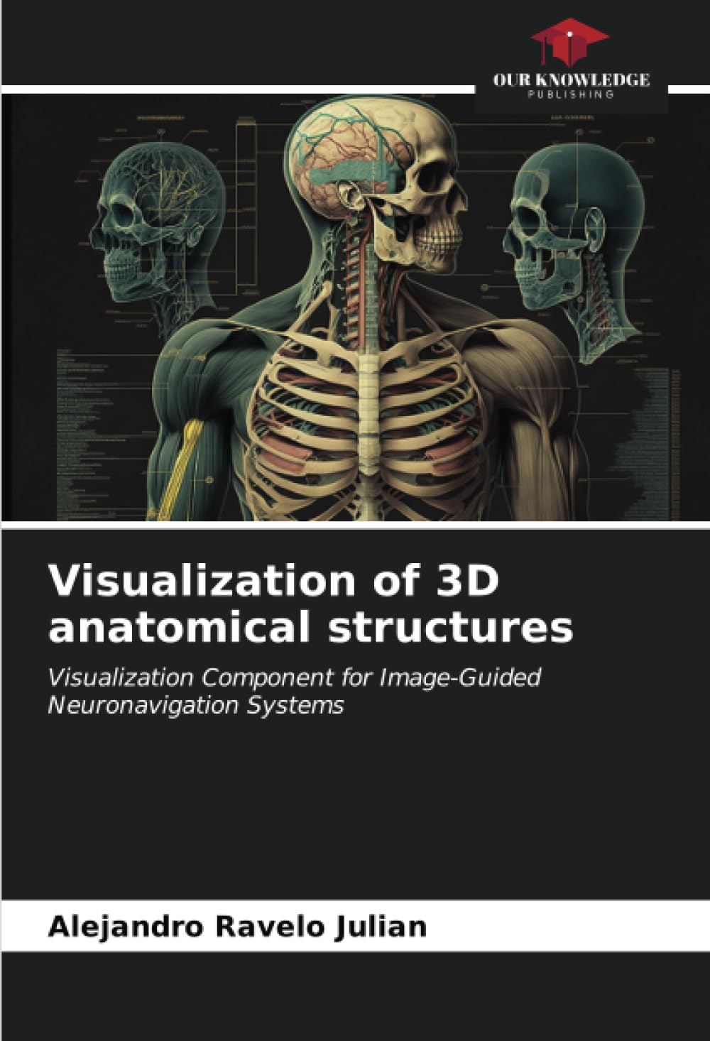 Visualization of 3D anatomical structures: Visualization Component for ...