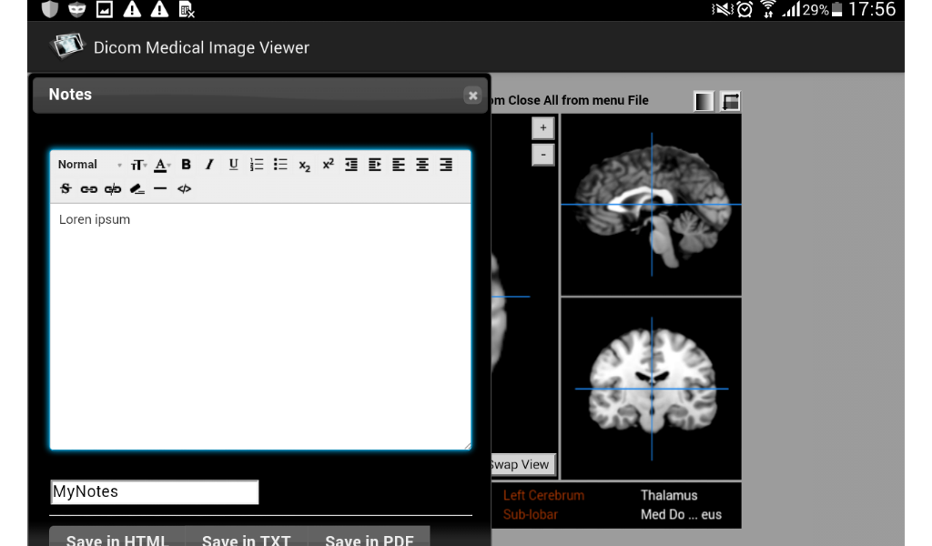 Dicom Medical Image Viewer-Amazonアプリストアのアプリ