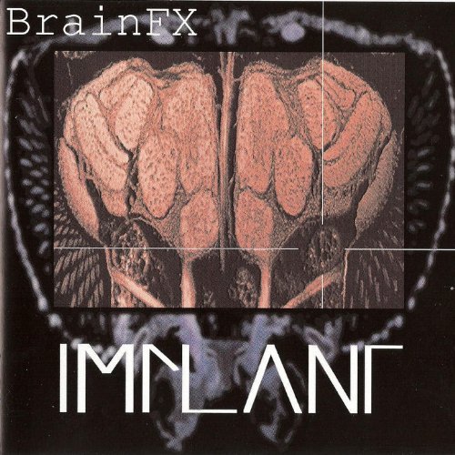 Amazon.com: BrainFX : Implant: Digital Music