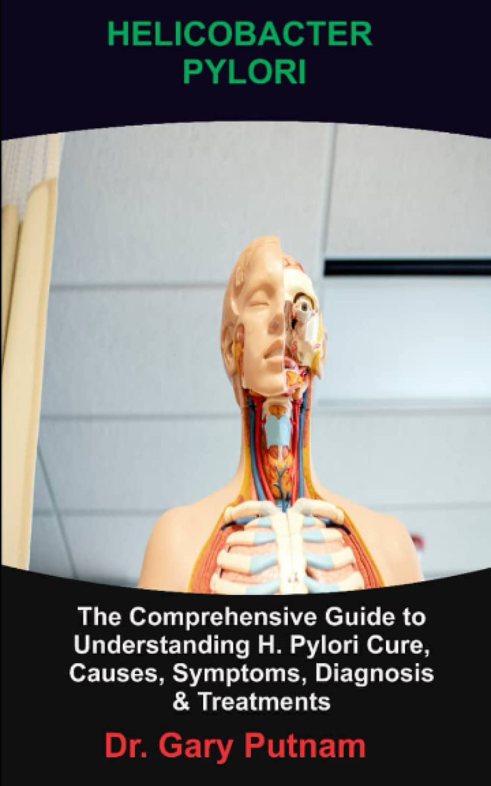 Buy HELICOBACTER PYLORI: The Comprehensive Guide to Understanding H ...