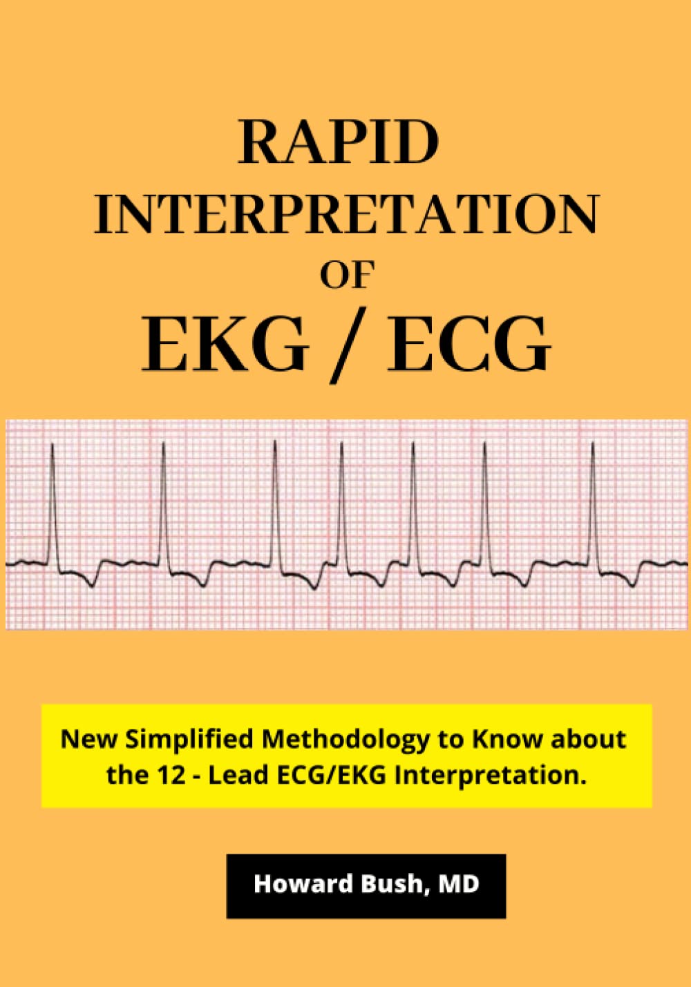 Rapid Interpretation Of Ekg Ecg New Simplified Methodology To Know ...