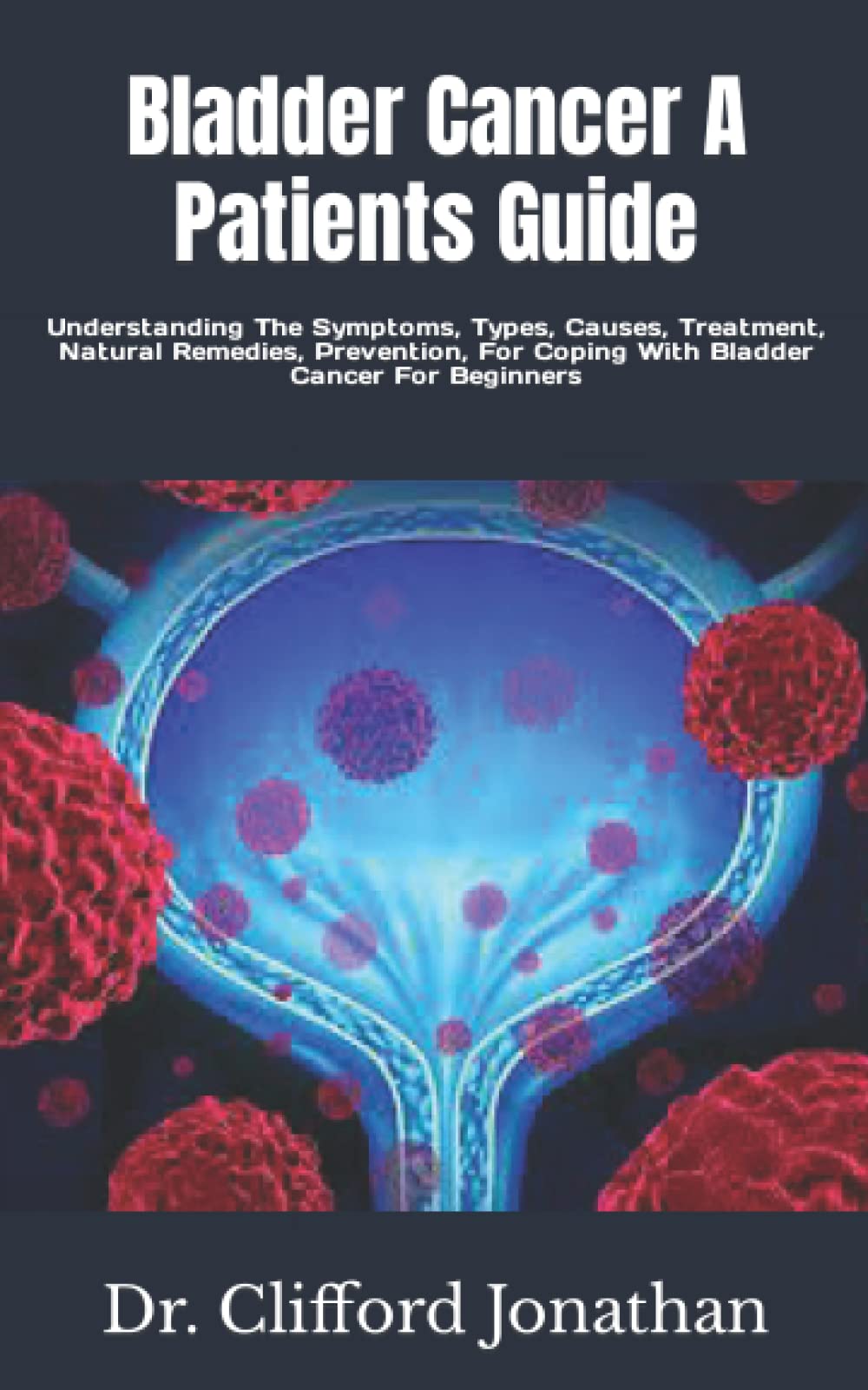 Buy Bladder Cancer A Patients Guide: Understanding The Symptoms, Types ...