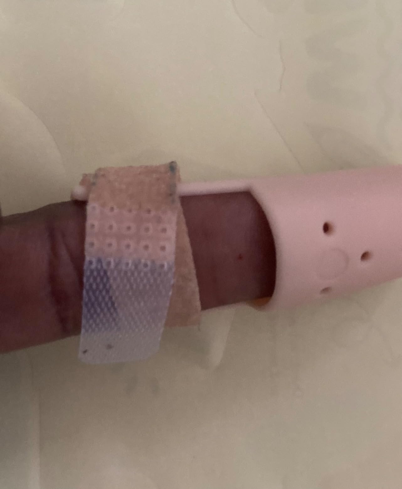 YANWANDEFA 5 Pcs Plastic Finger Support Protector Finger Splint Mallet ...