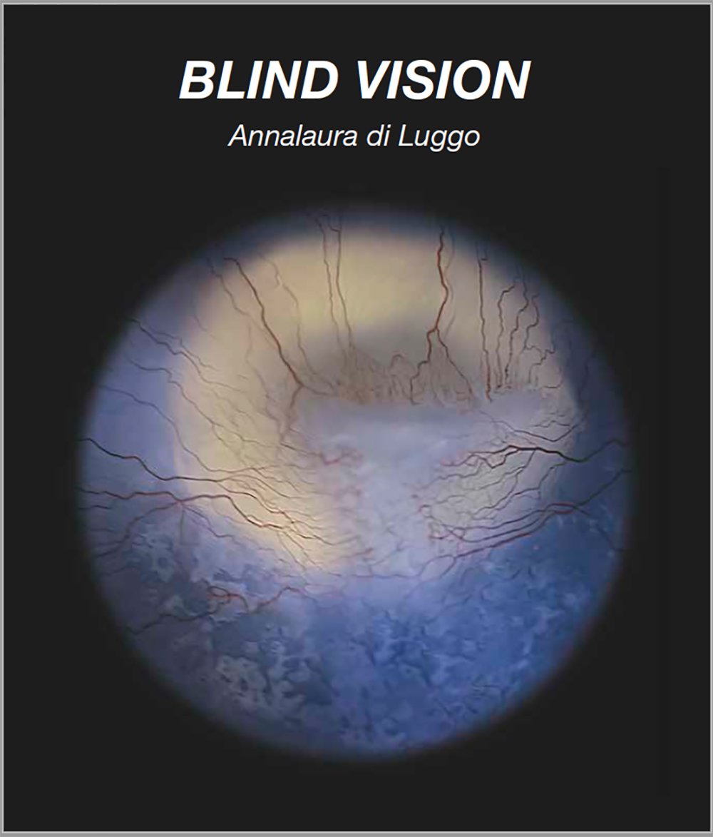 Amazon.com: Blind Vision - Annalaura di Luggo: a cura di Raisa Clavijo ...