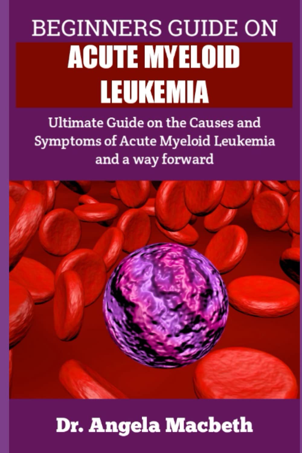 Buy BEGINNERS GUIDE ON ACUTE MYELOID LEUKEMIA: Ultimate Guide on the ...