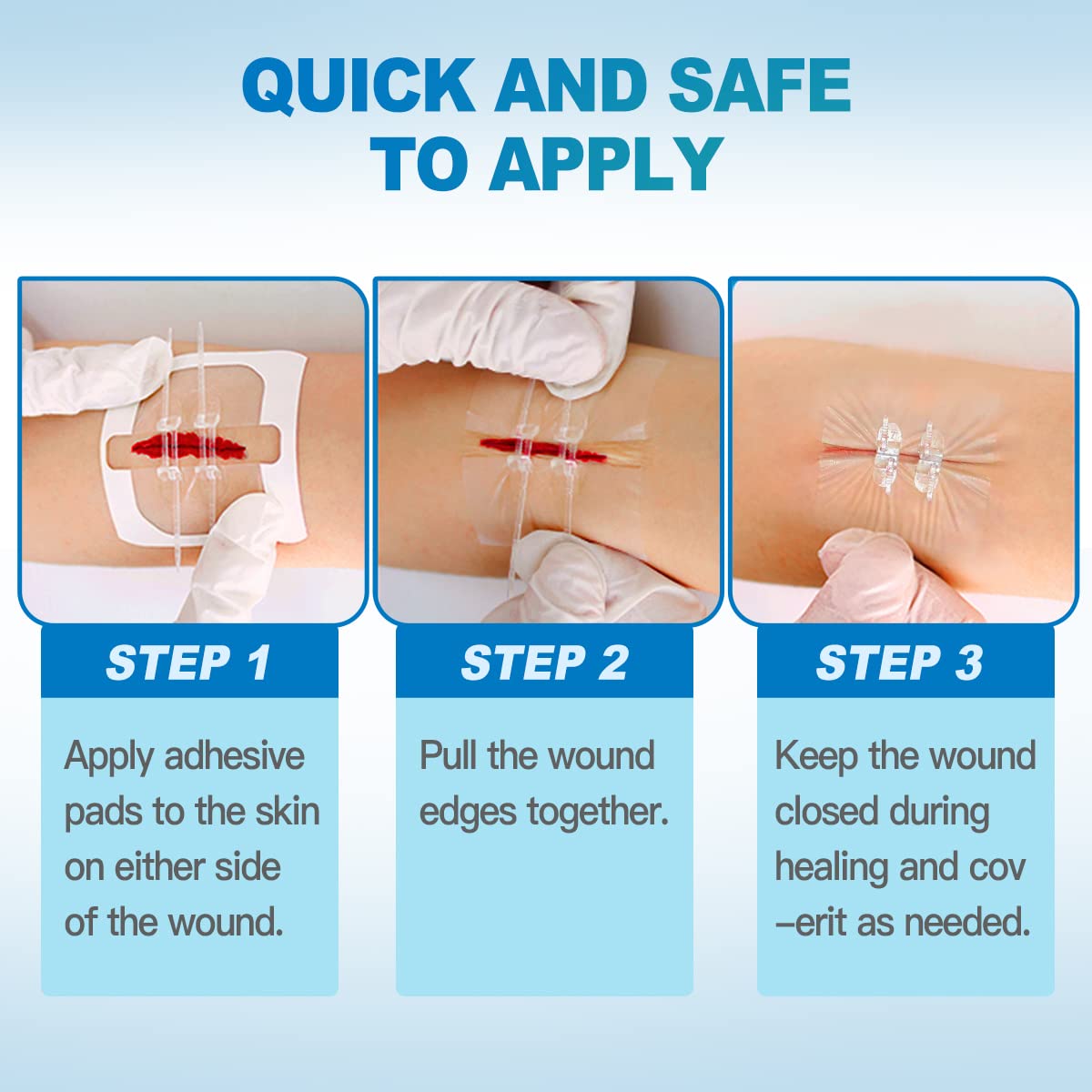 Snapklik.com : Senvok Butterfly Bandaids For Wound Closure, 2 Pcs Zip ...