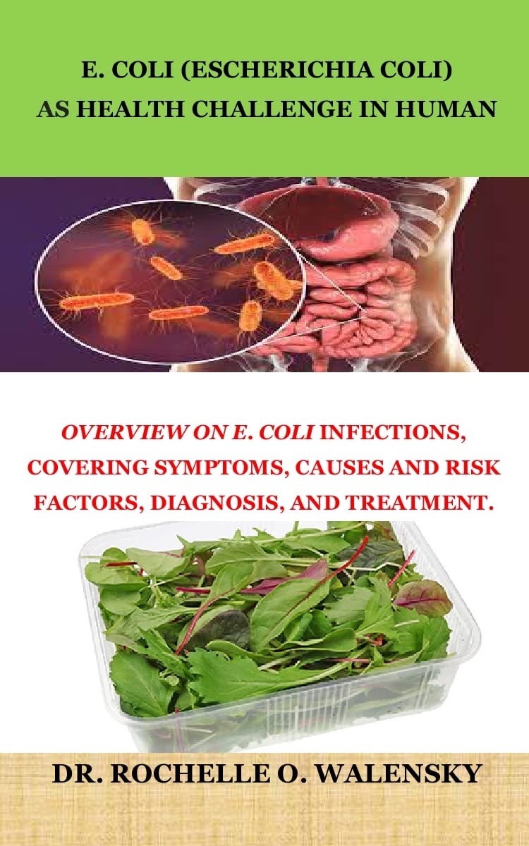 Buy E. COLI (ESCHERICHIA COLI) AS CHALLENGE IN HUMAN: OVERVIEW ON E ...