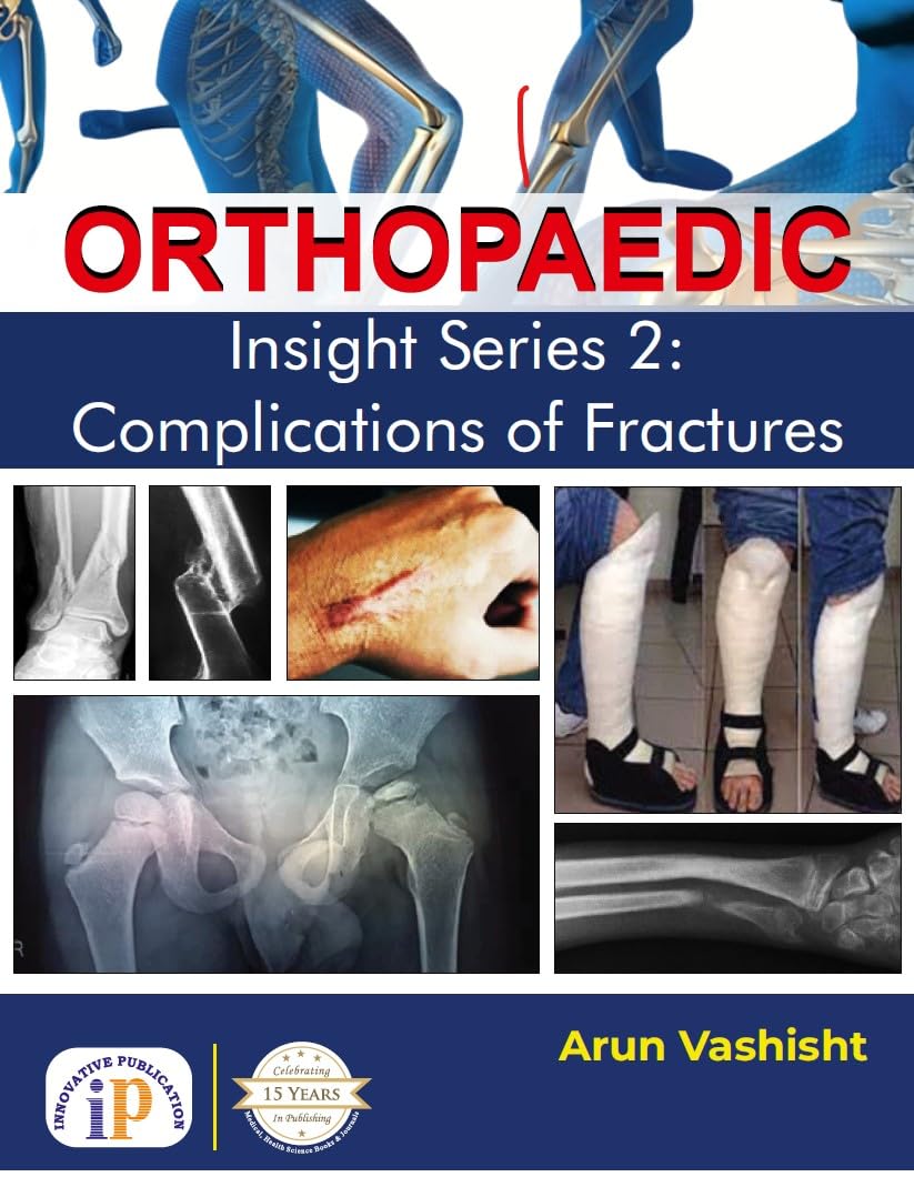 Buy Orthopaedic Insight Series 2: Complications of Fractures Book ...