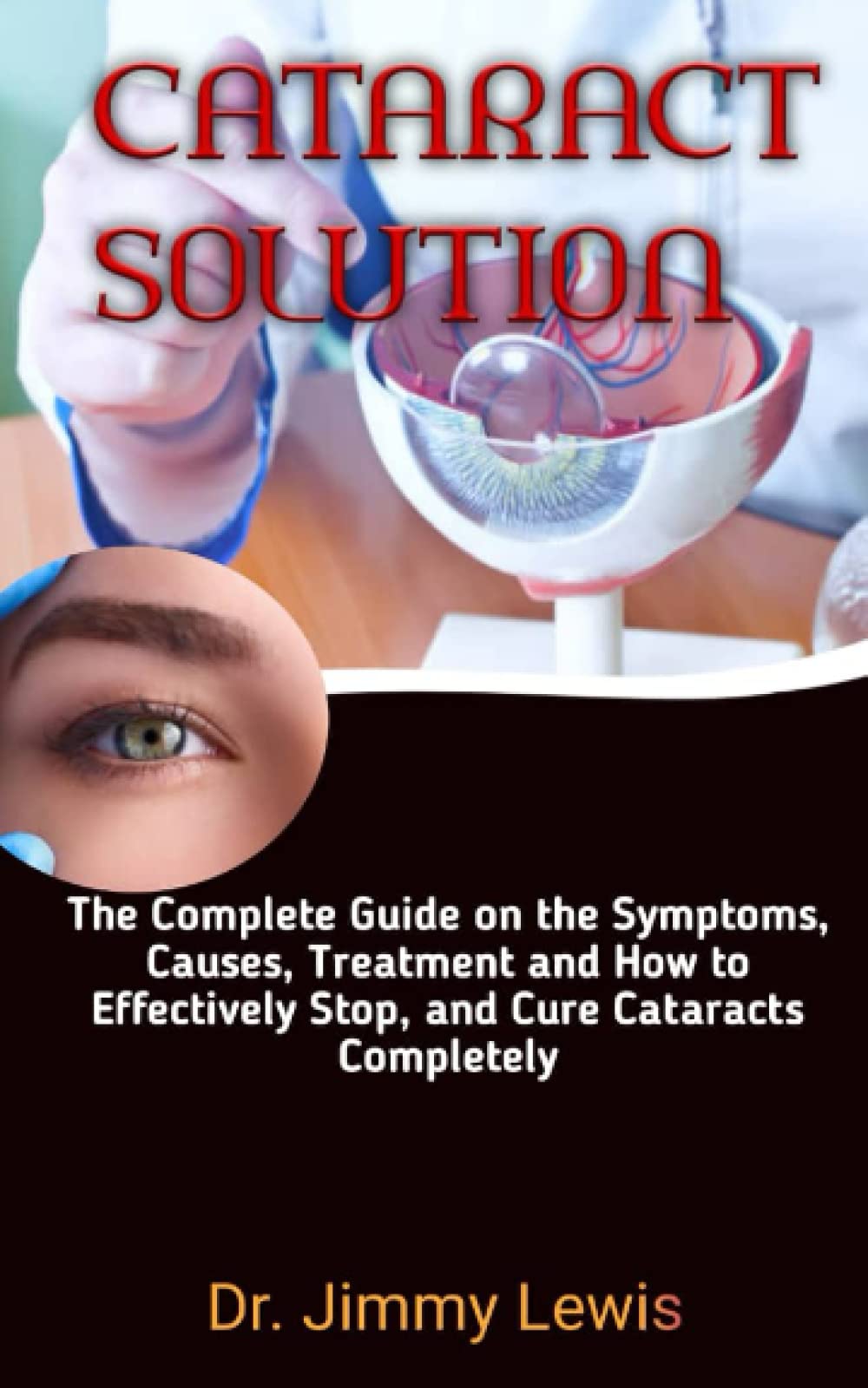 Buy CATARACT SOLUTION: The Complete Guide On The Symptoms, Causes, And ...