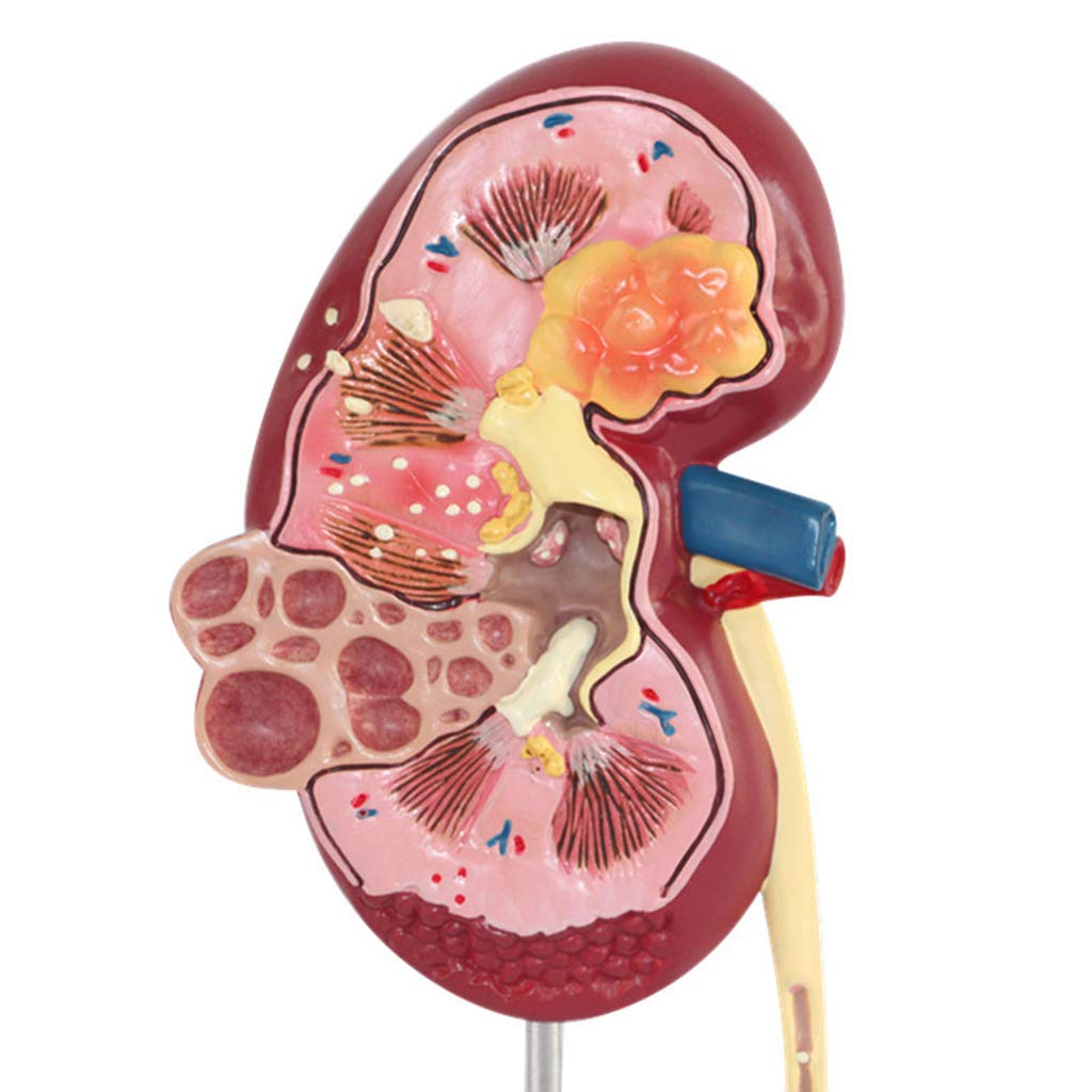 Buy Human Anatomy Science Models - Human Kidney Anatomical Model - Pvc ...