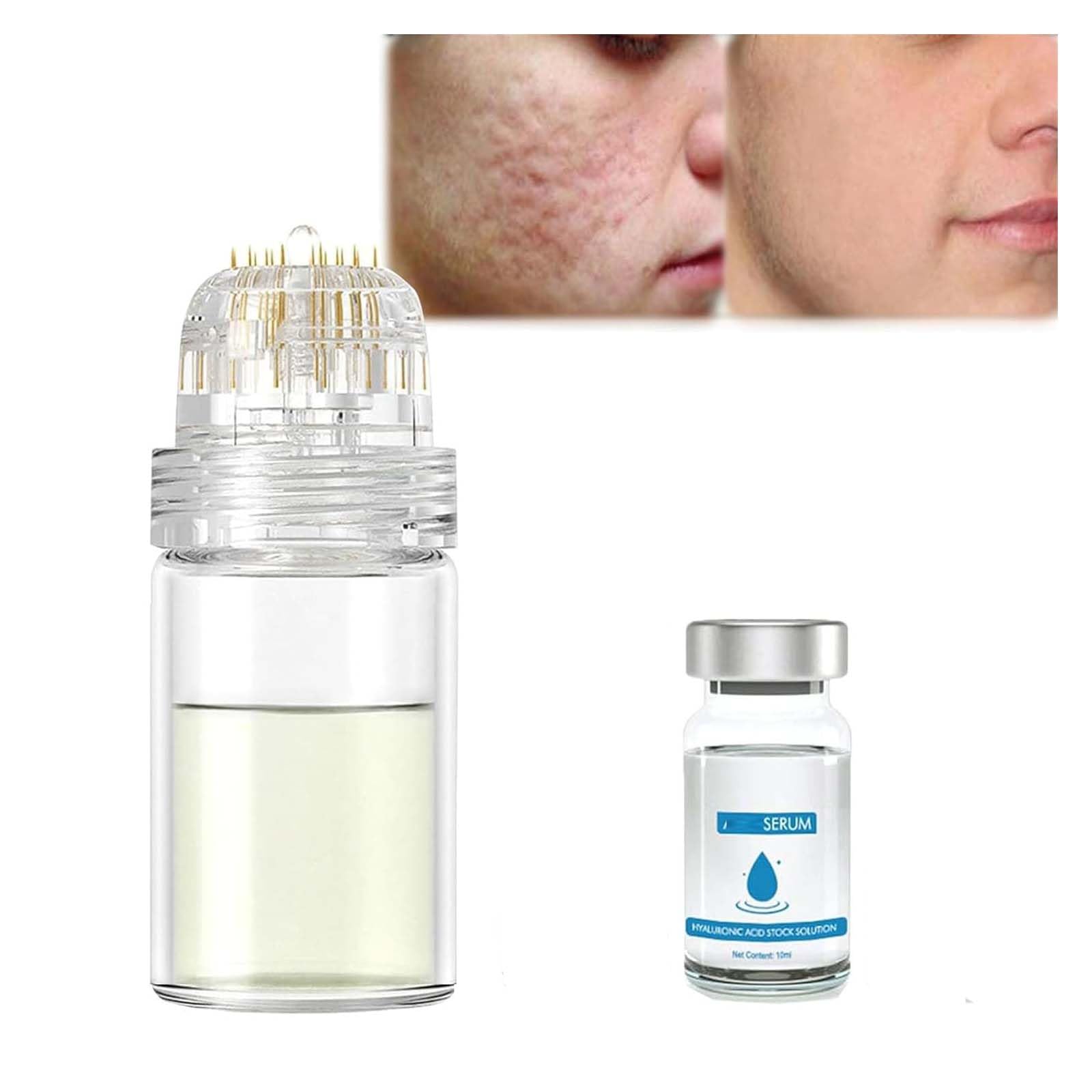 Glamor Y Glamor Y Micro Infusion System For Face Glamor | Desertcart ...