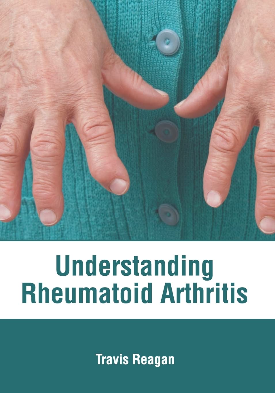 Understanding Rheumatoid Arthritis: 9781639274789: Medicine & Health ...