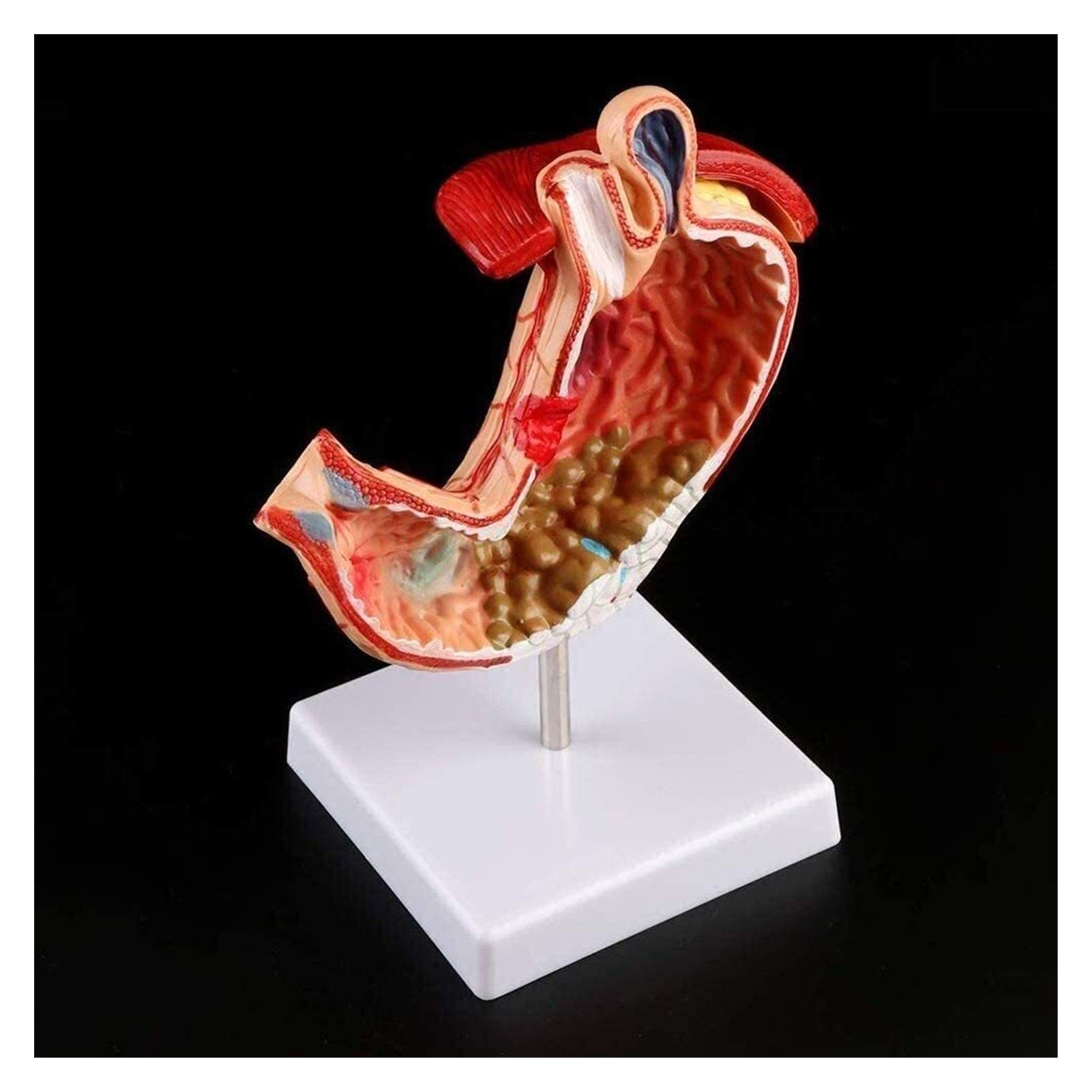 Skeleton Anatomical Model Stomach Anatomy Model Gastric Pathology ...