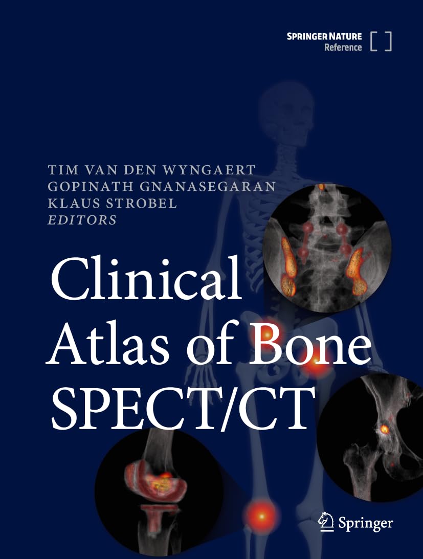 Buy Clinical Atlas of Bone SPECT/CT Book Online at Low Prices in India ...